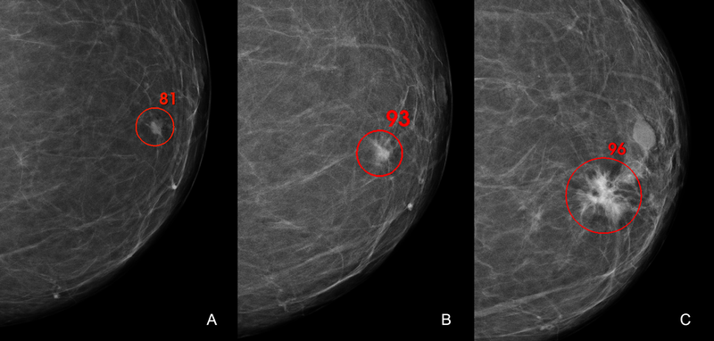 Transpara | Evolutive Medica